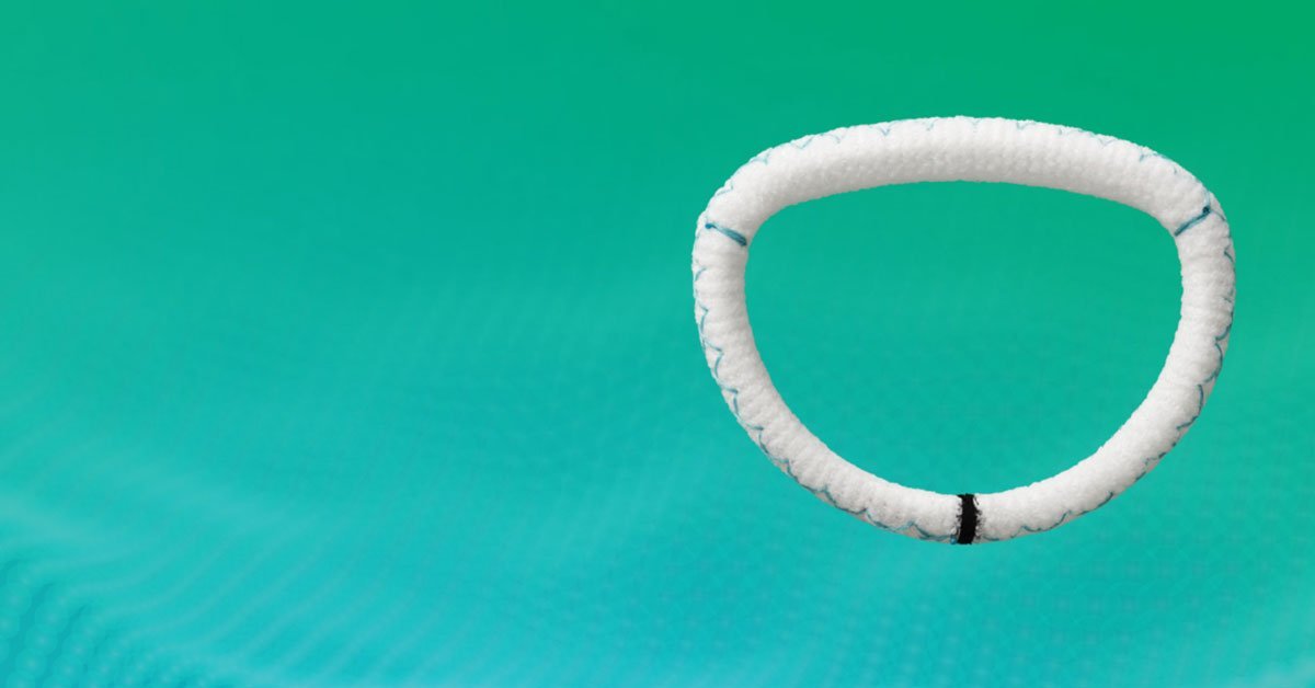 Mitral Valve Repair Solutions | Mitral Valve Annuplasty Ring