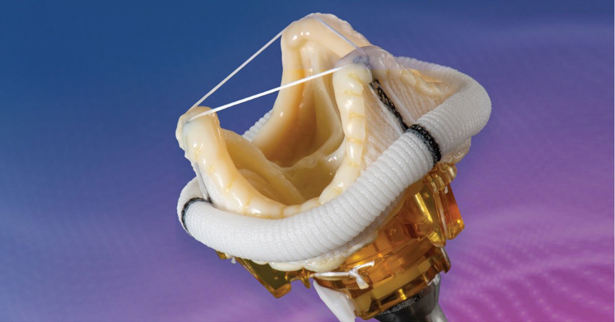 Surgical Valve Solutions | Repair Aortic & Mitral Valve