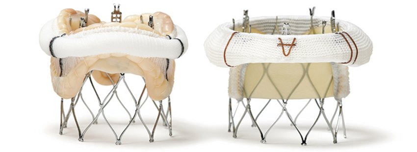 Epic Plus Mitral and Aortic Stented Tissue Valves | Abbott