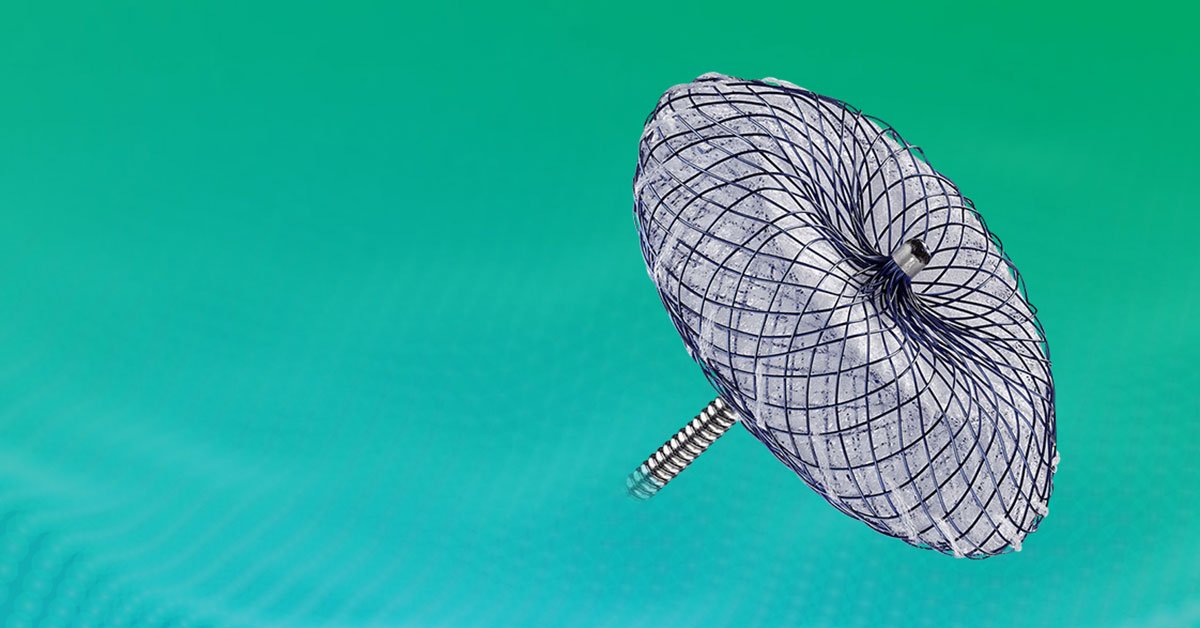 Amplatzer Septal Occluder Clinical Data | Abbott