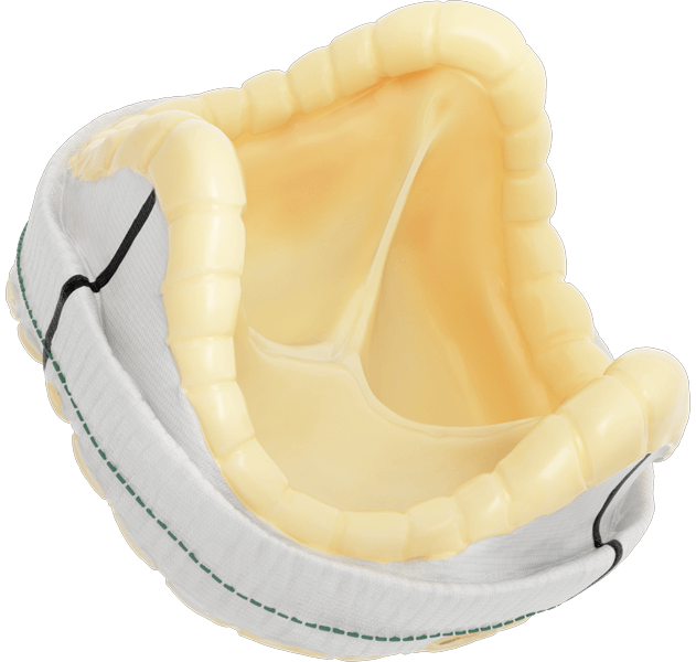 Epic Max Aortic Stented Tissue Valves | Abbott